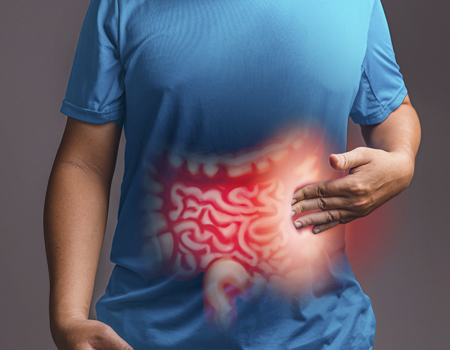 Colón Irritável - Clinica São Brás