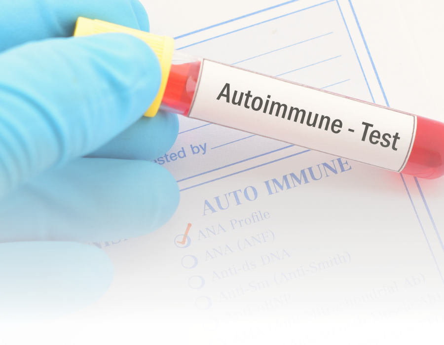Doença Autoimune e Câncer - Clinica São Brás